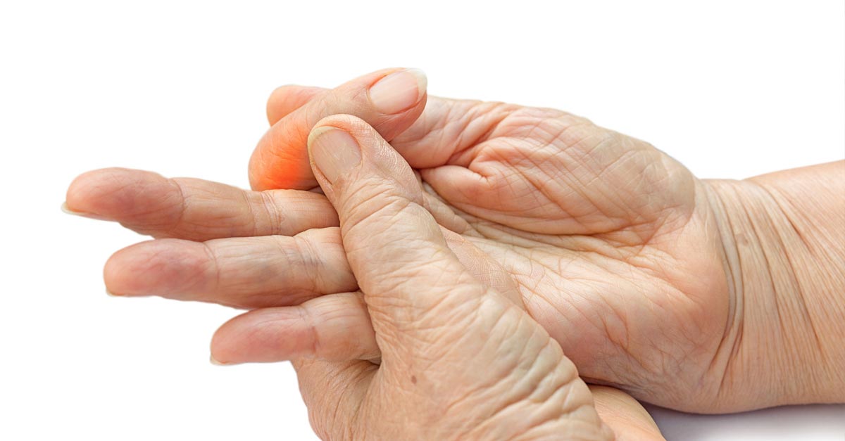 Morbus Dupuytren – krumme Finger | A.Vogel